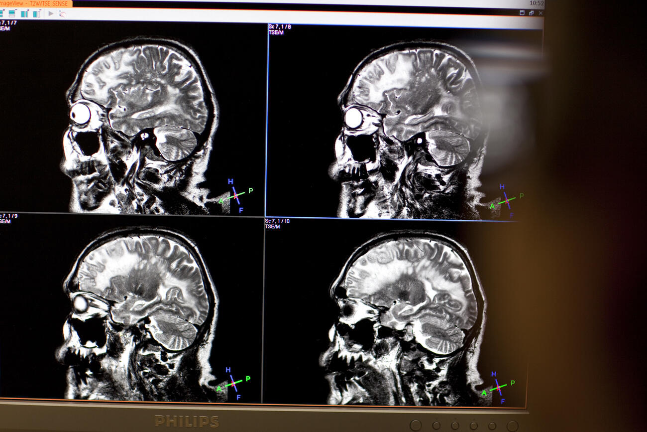 New AI technique allows live look into brain processes | Naratek