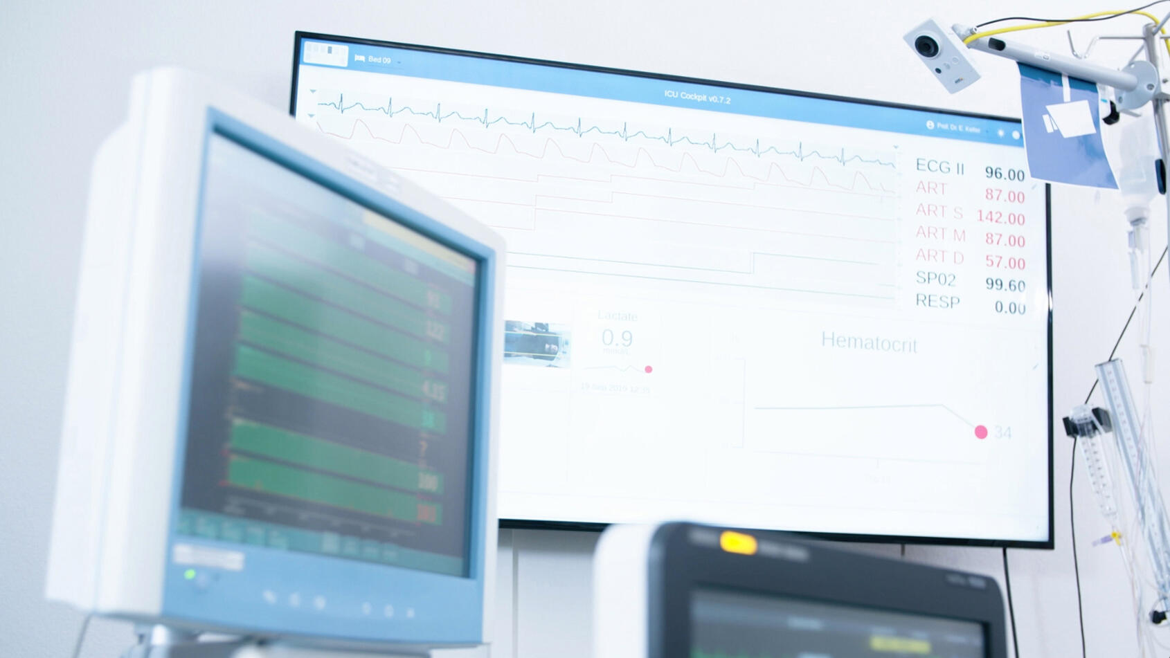 Reducing false alarms in ICUs – thanks to big data | Naratek
